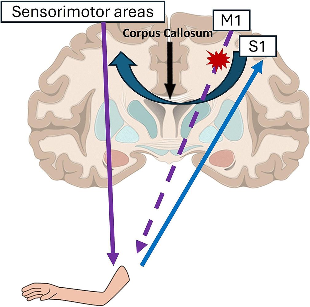 Research – Illinois-Carle Joint Neural Engineering and Rehabilitation ...