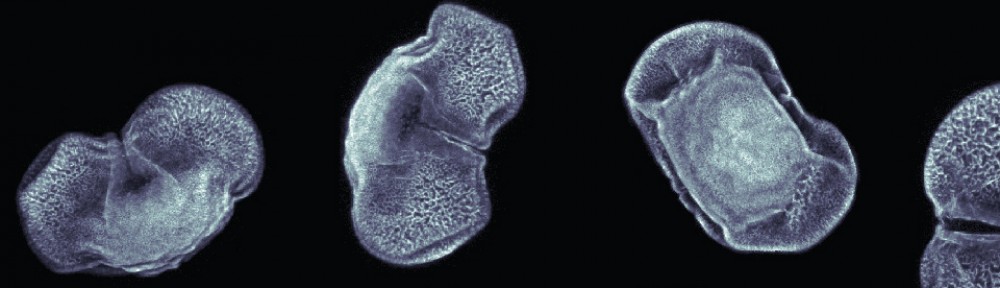 Punyasena Pollen and Paleoecology Research Group | palynology ...